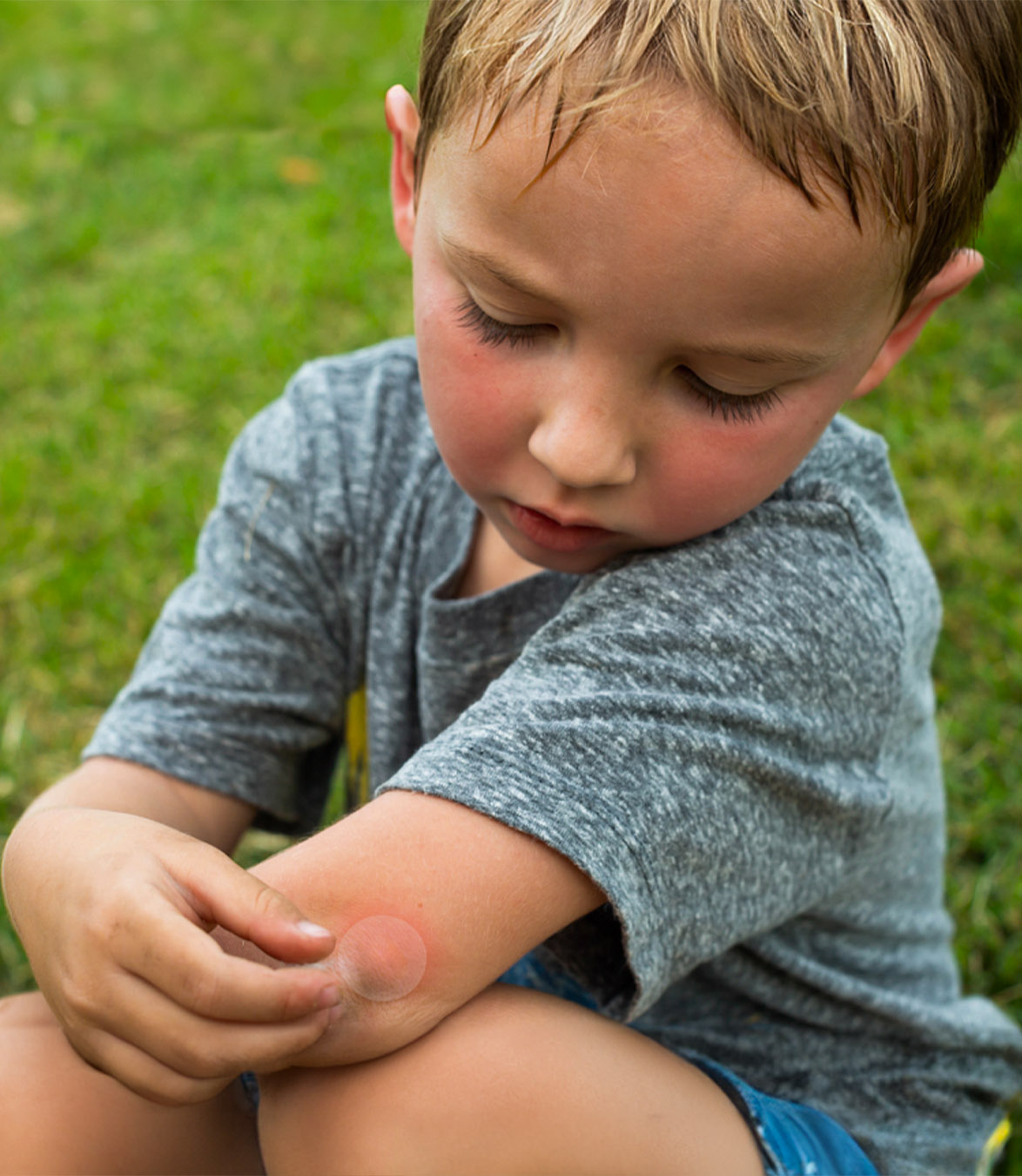 Sarna Bug Bite Patches with Skin-Soothing Ingredients