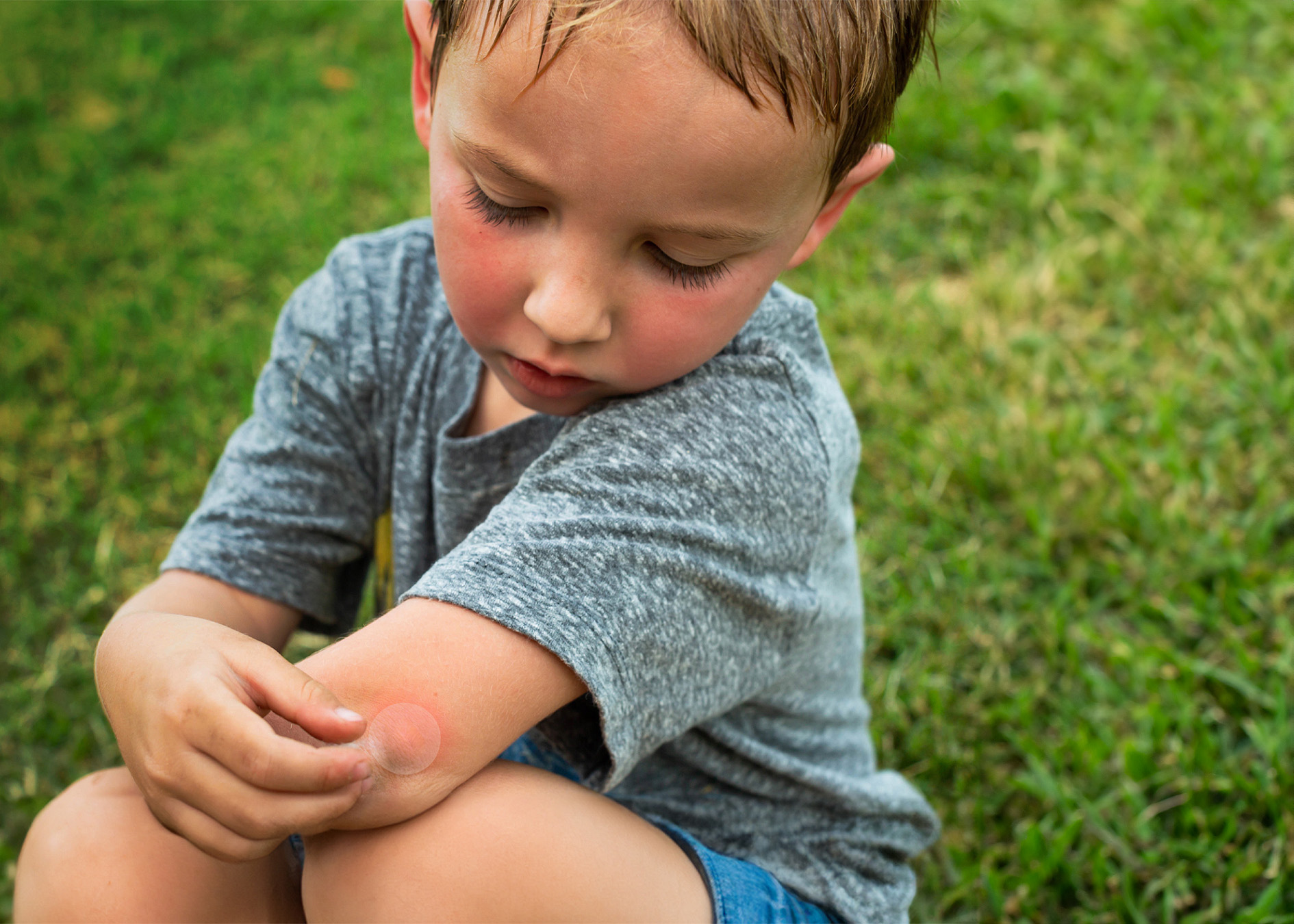 Sarna Bug Bite Patches with Skin-Soothing Ingredients
